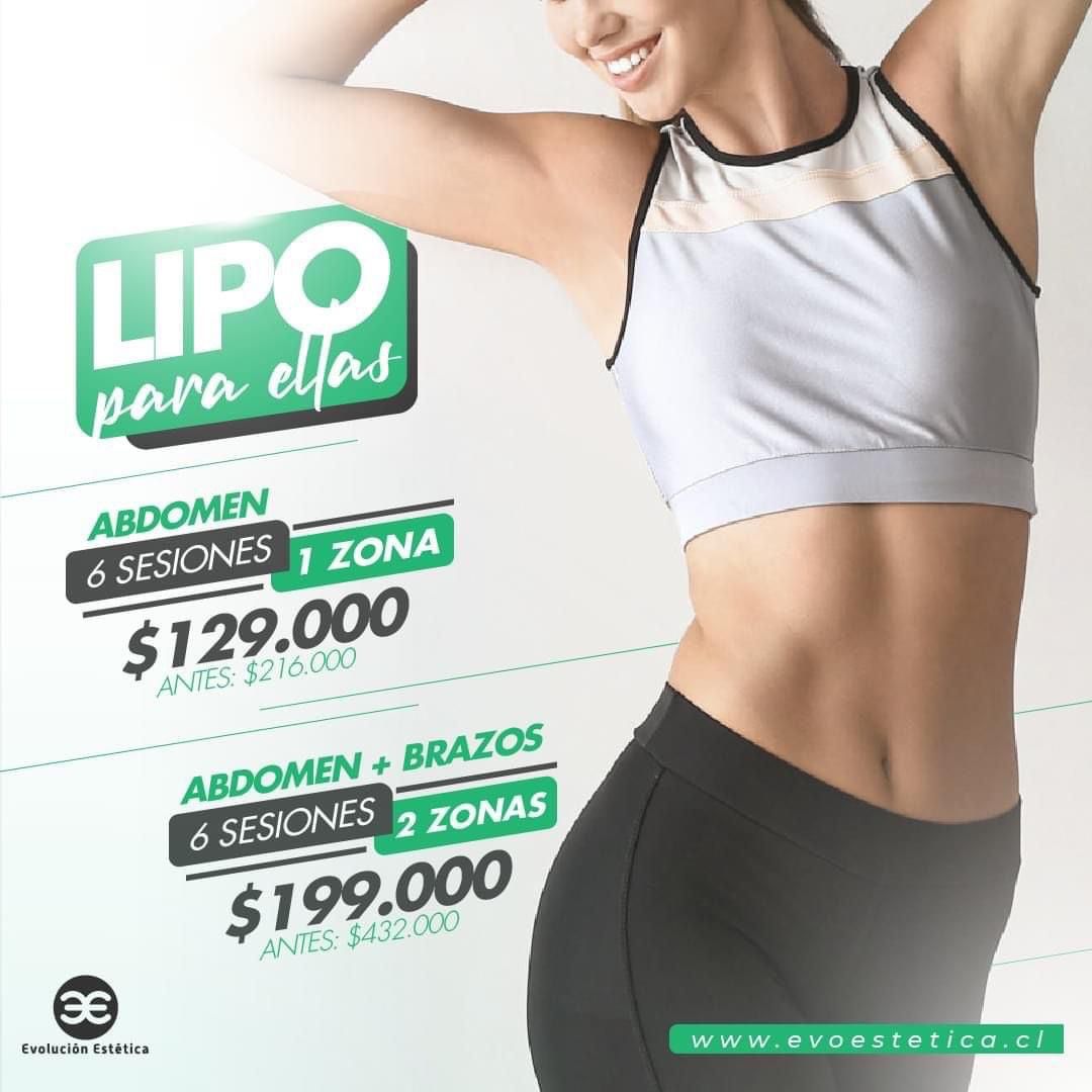 Liposucción Sin Cirugía – Evolución Estética